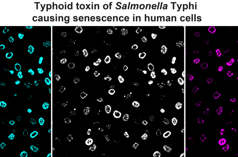 The hijacked cell: Breaking the typhoid infection cycle - Take on Typhoid