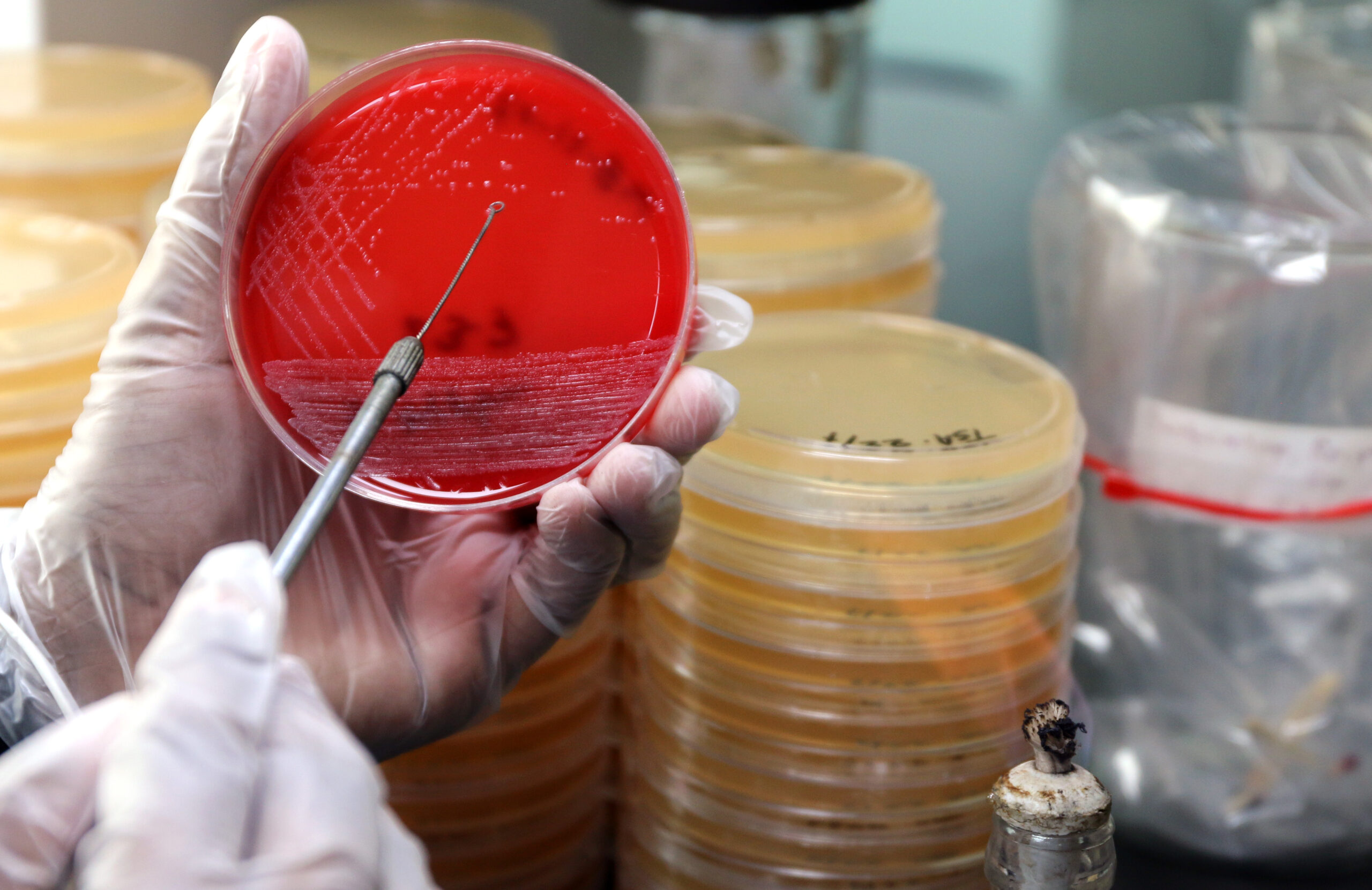 The alarming spread of drug-resistant typhoid - Take on Typhoid